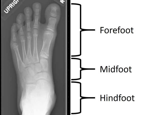 Pediatric foot alignment: Dr Sachin Kumbhar’s talk – Cafe Roentgen