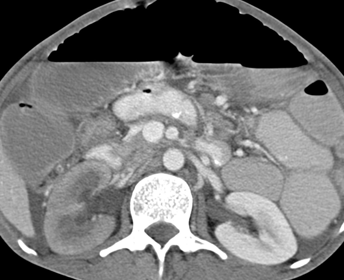The Findings (Body) of the Radiology Report: What to say and how to say ...