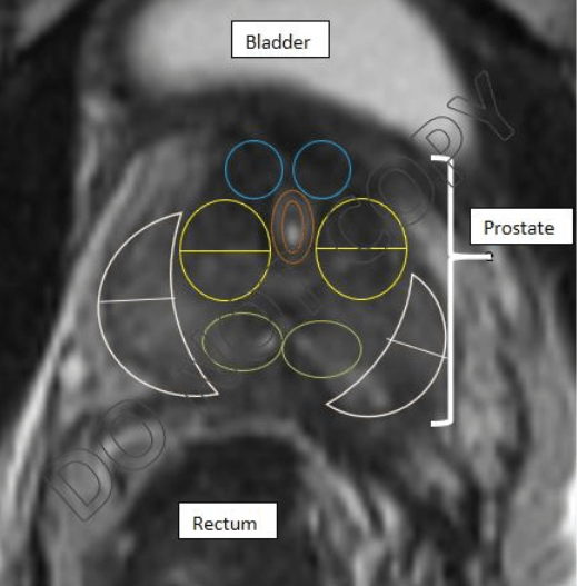 Prostate Mri Anatomy