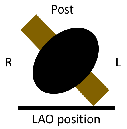 ICU Chest X-ray: Dr Ravi Ramakantan’s film reading session – Cafe Roentgen