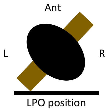 ICU Chest X-ray: Dr Ravi Ramakantan’s film reading session – Cafe Roentgen